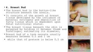 Gestational age estimation- pediatrics.pptx