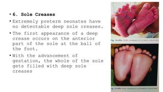 Gestational age estimation- pediatrics.pptx