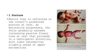 Gestational age estimation- pediatrics.pptx