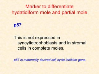 Gestational trophoblastic disease | PPT