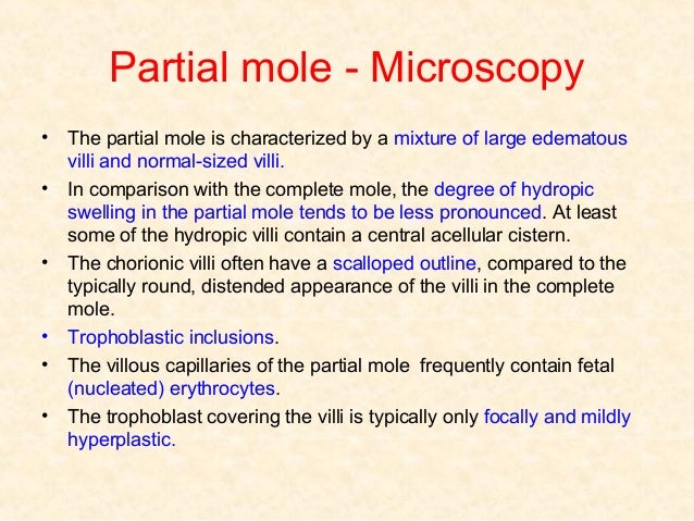 Gestational trophoblastic disease