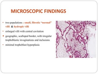 Gestational trophoblastic disease | PPTX