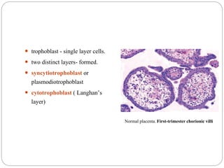Gestational trophoblastic disease | PPTX