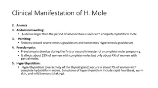 Gestational Trophoblastic Disease -MBChB 6th Year 2018.pptx | Pregnancy ...