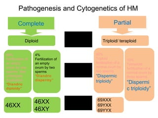Gestational trophoblastic disease by sittichoke | PPT
