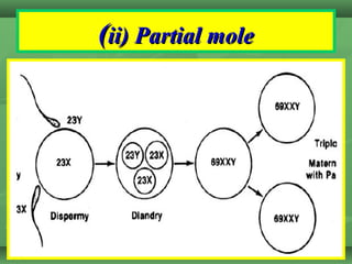 Gestational trophoblastic disease for undergraduate | PPT