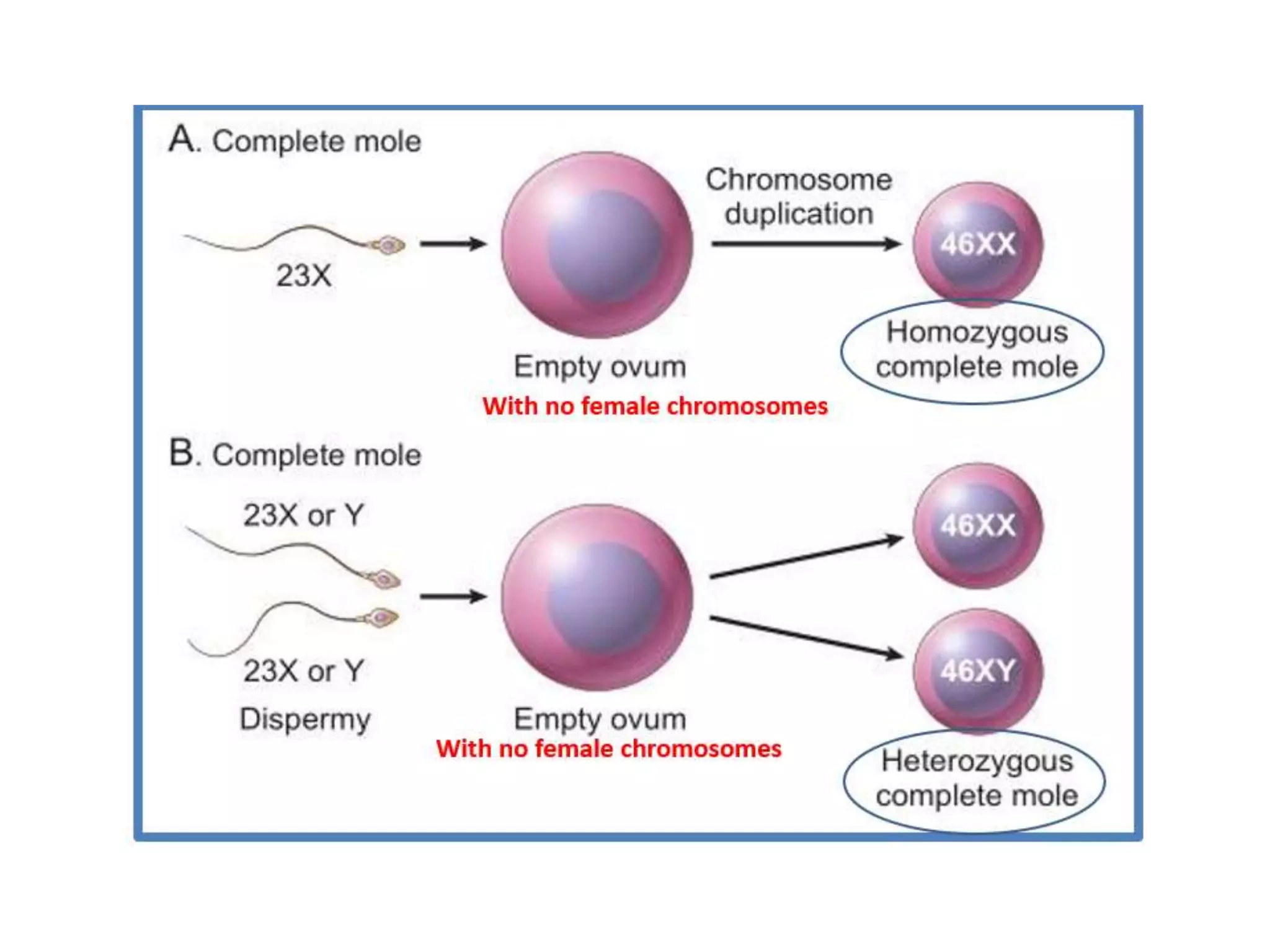 Gestational trophoblastic disease (GTD).pptx