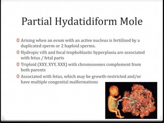 Gestational trophoblastic disease natangwe | PPT