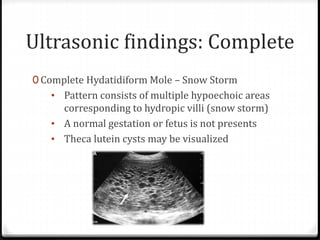Gestational trophoblastic disease natangwe | PPT