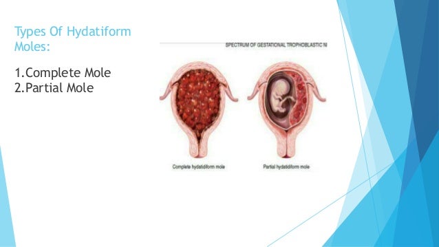 Gestational trophoblastic diseases