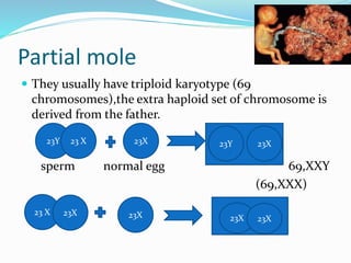 Gestational Trophoblastic Diseases (GTD).pptx