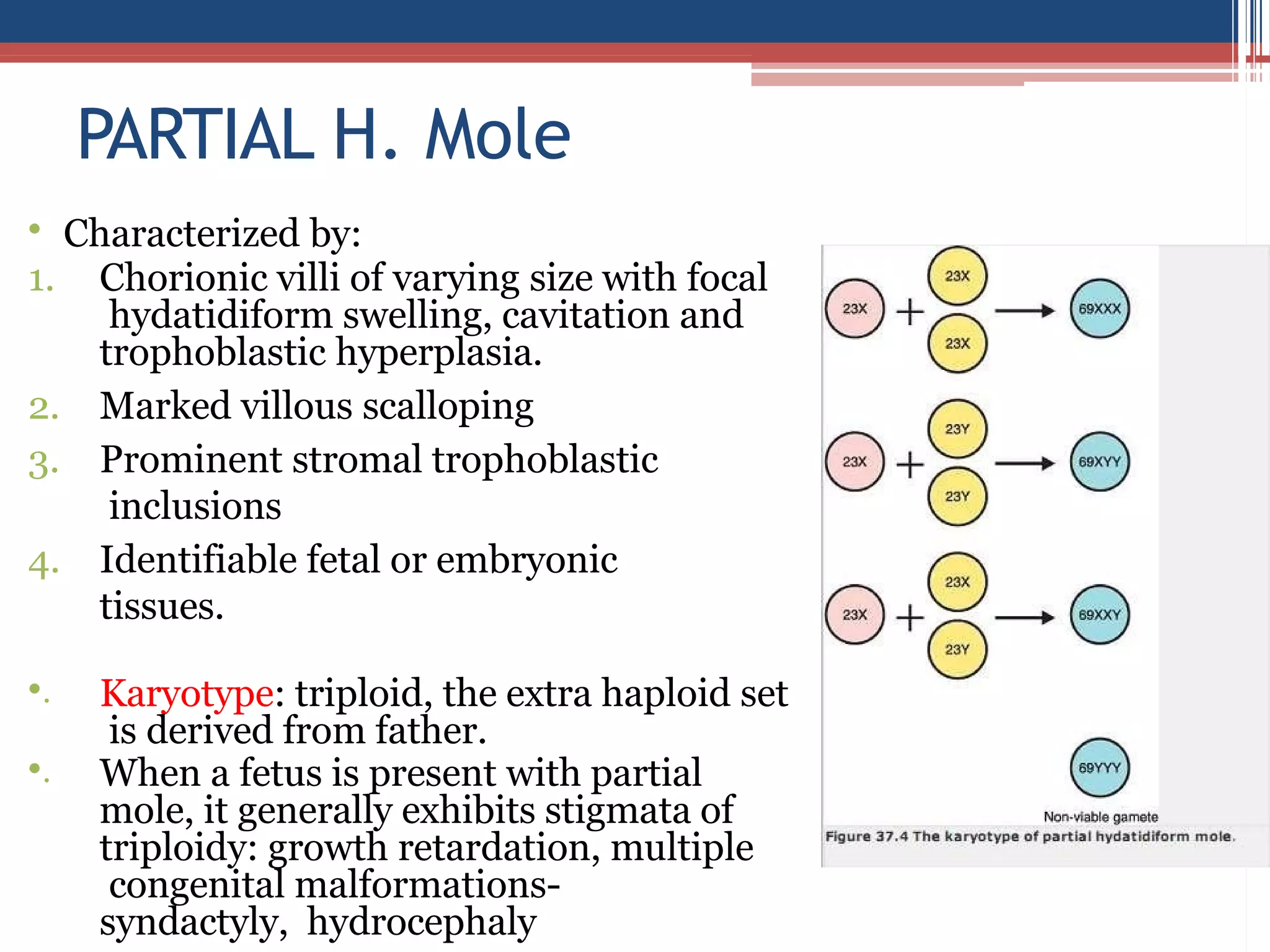 Gestational trophoblastic neoplasia management | PPT