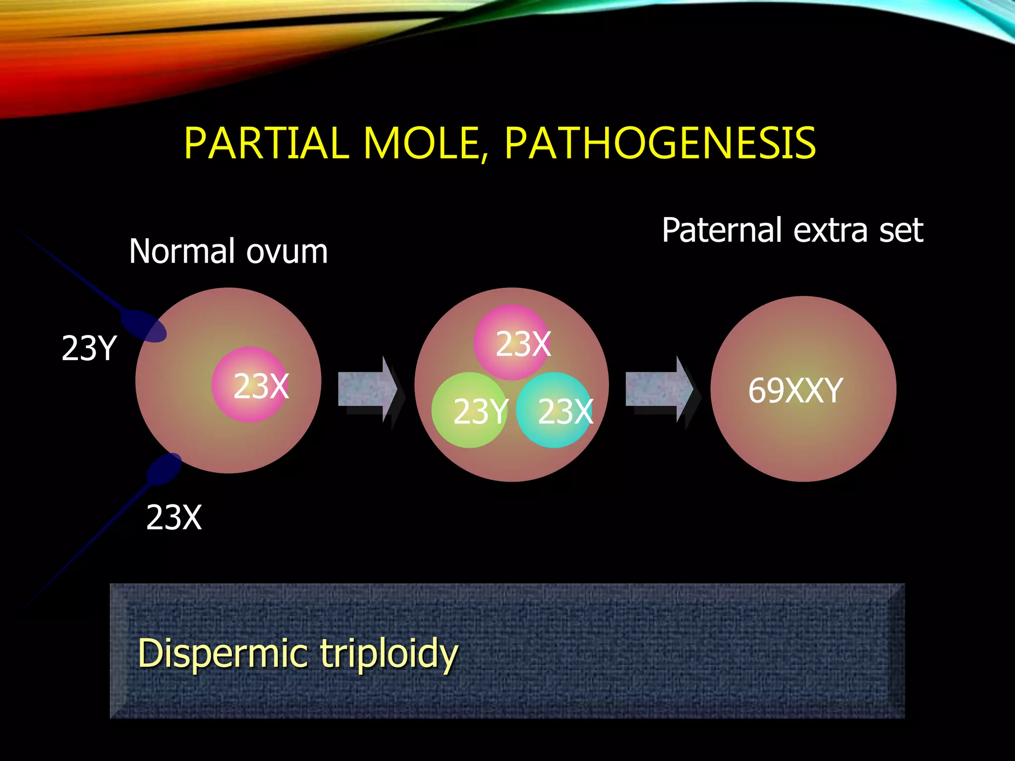 Gestational trophoblastic neoplasia | PPTX