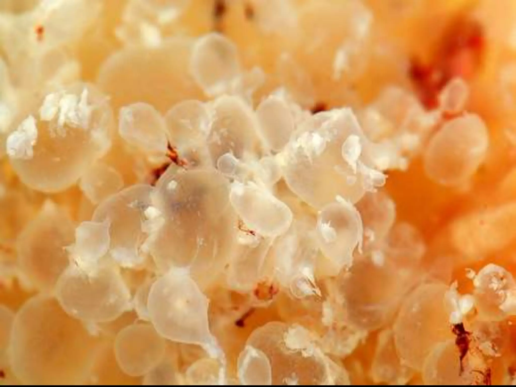 Gestational trophoblastic neoplasia | PPTX