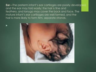 Gestational age assessment of infant | PPTX