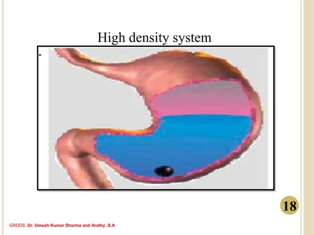 Gestro retention drug delivery system, by dr. umesh kumar sharma ...