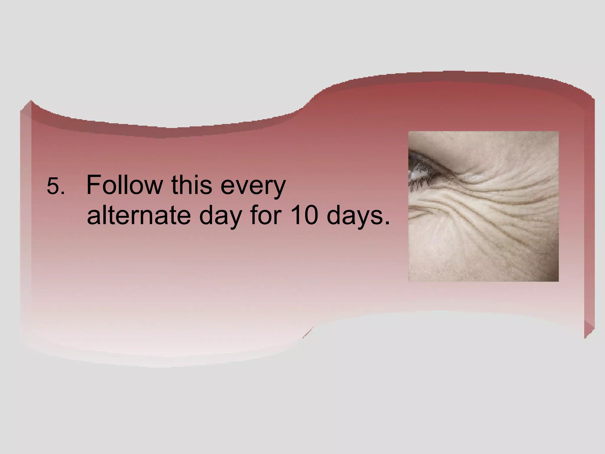 Get Rid Of Crow’s Feet | PPT