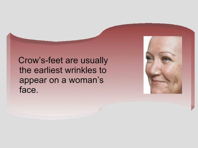 Get Rid Of Crow’s Feet | PPT