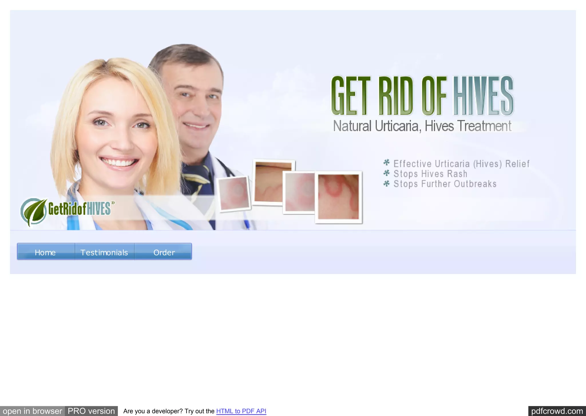 Get Rid of Hives | PDF