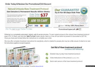 Get Rid of Hives | PDF