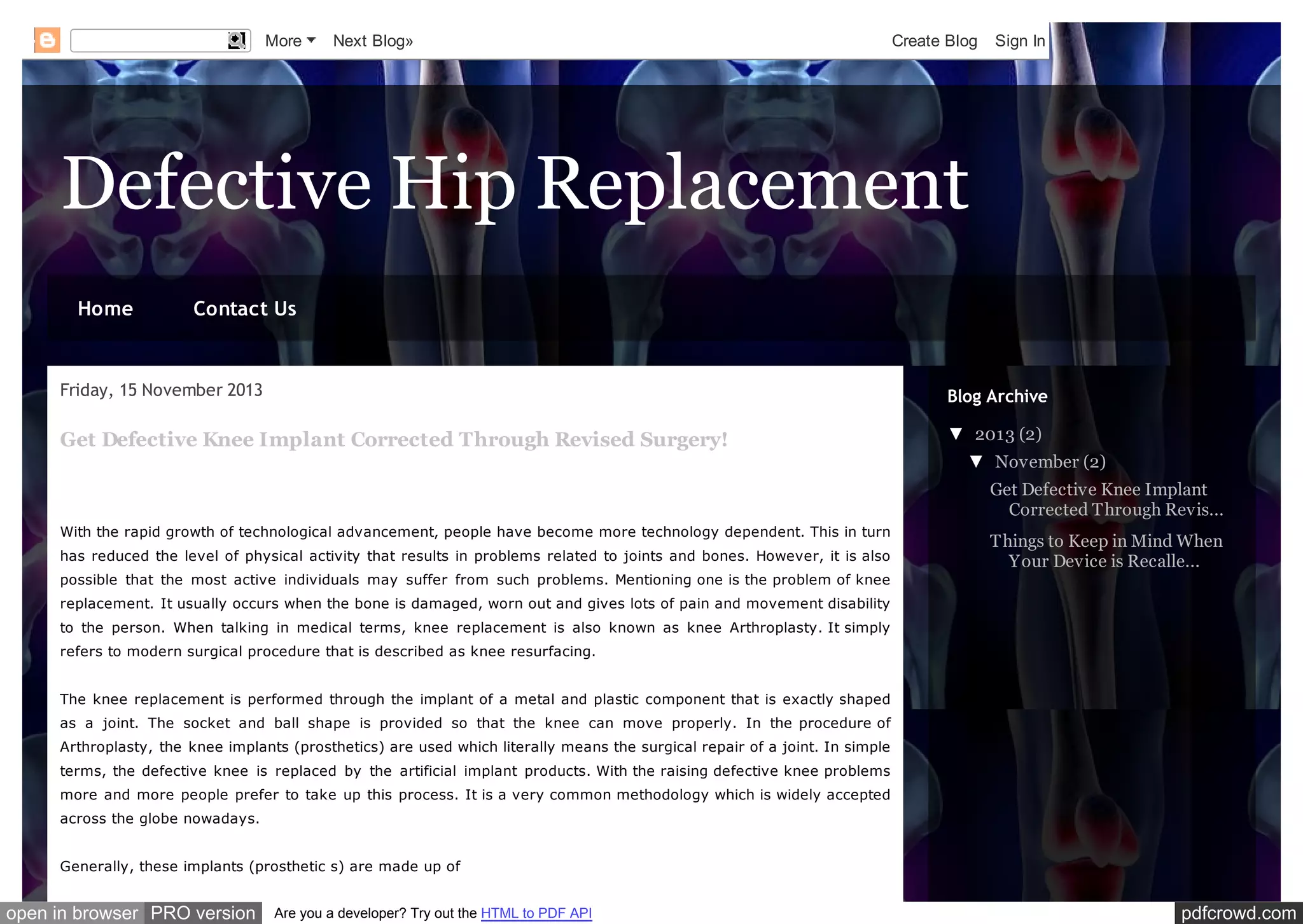 Get defective knee implant corrected through revised surgery! | PDF