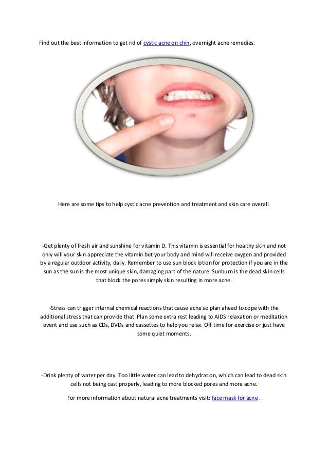 Get Rid Of Cystic Acne On Chin Get Rid Of Cystic Acne On Chin