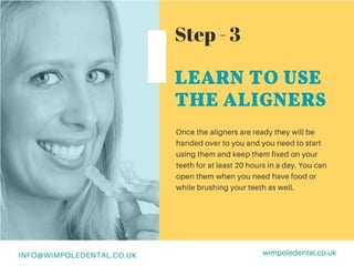 Get straight teeth without braces by invisalign