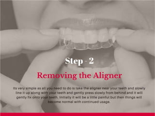 Get straight teeth without braces by invisalign