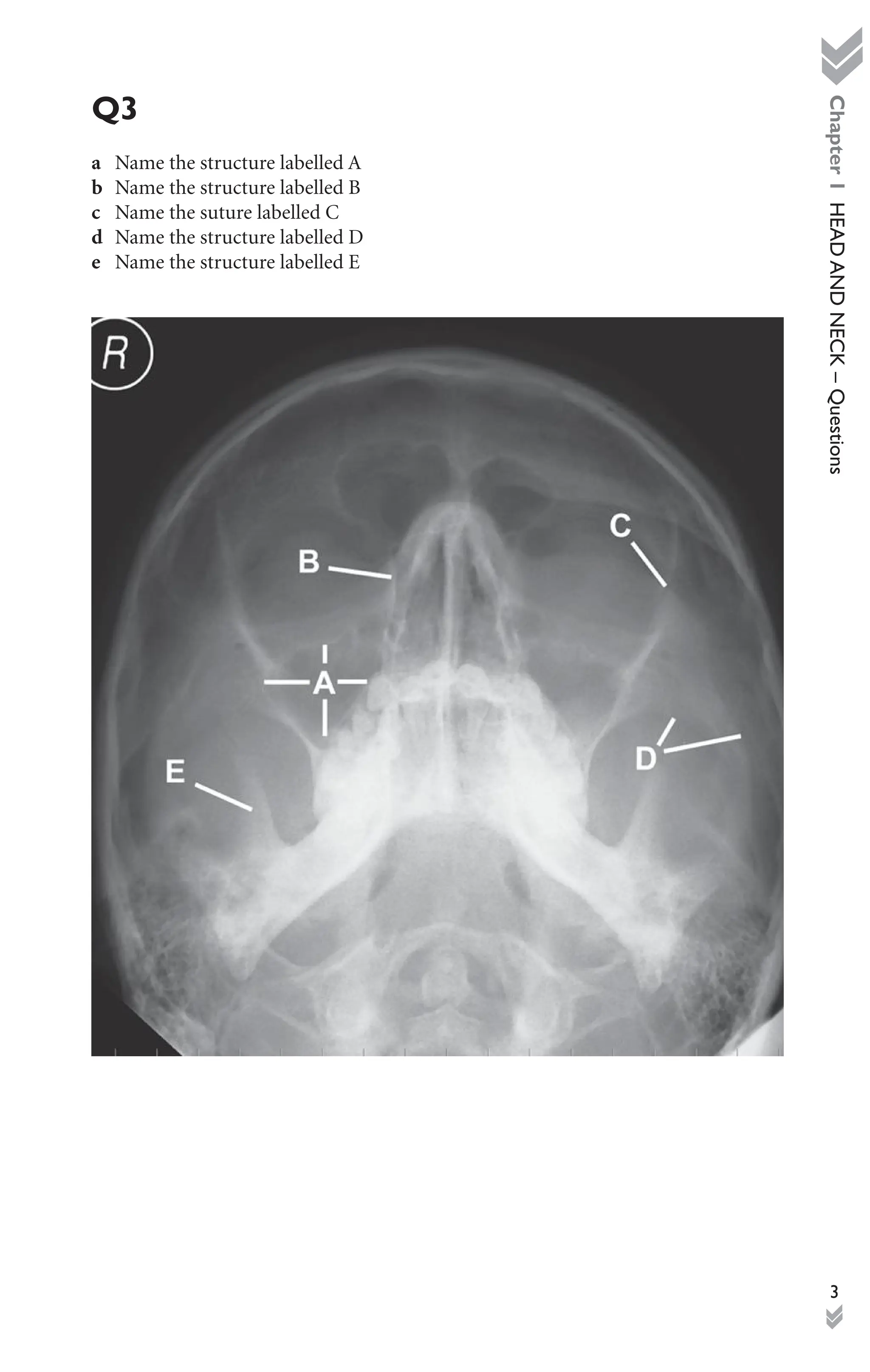 Get Through First FRCR Questions for the Anatomy Module.pdf