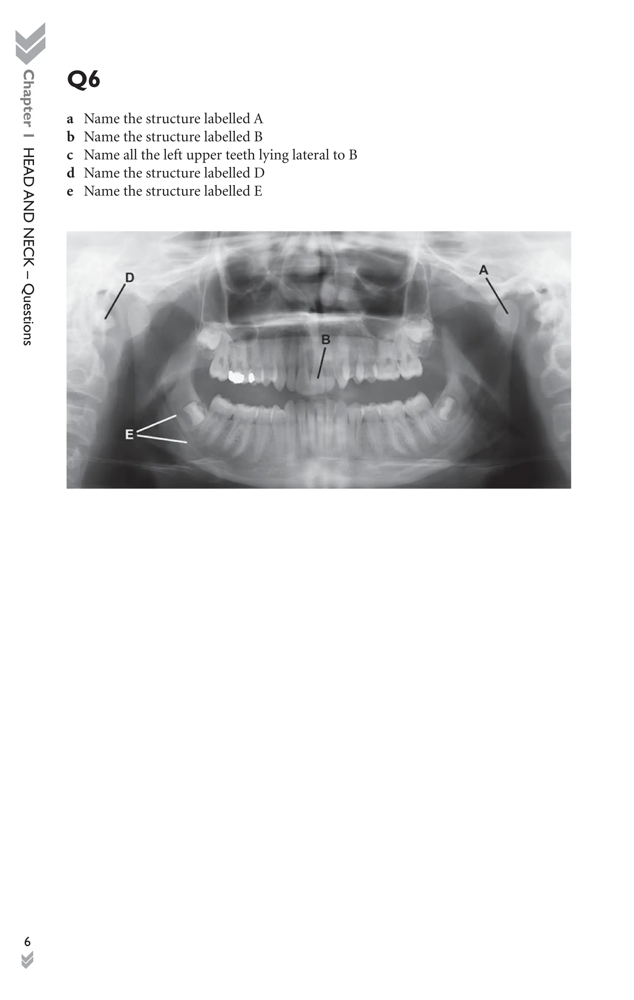 Get Through First FRCR Questions for the Anatomy Module.pdf