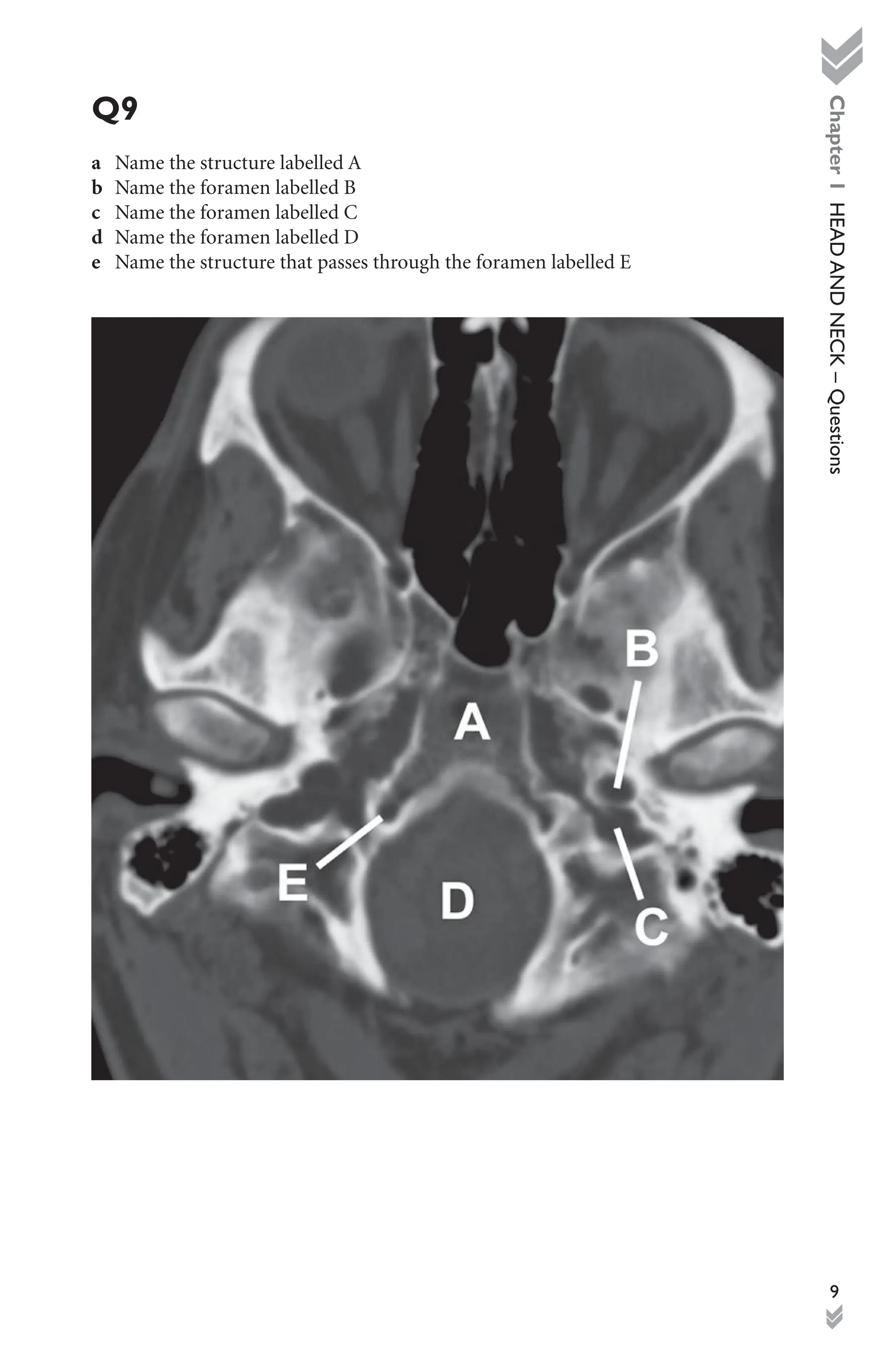Get Through First FRCR Questions for the Anatomy Module.pdf