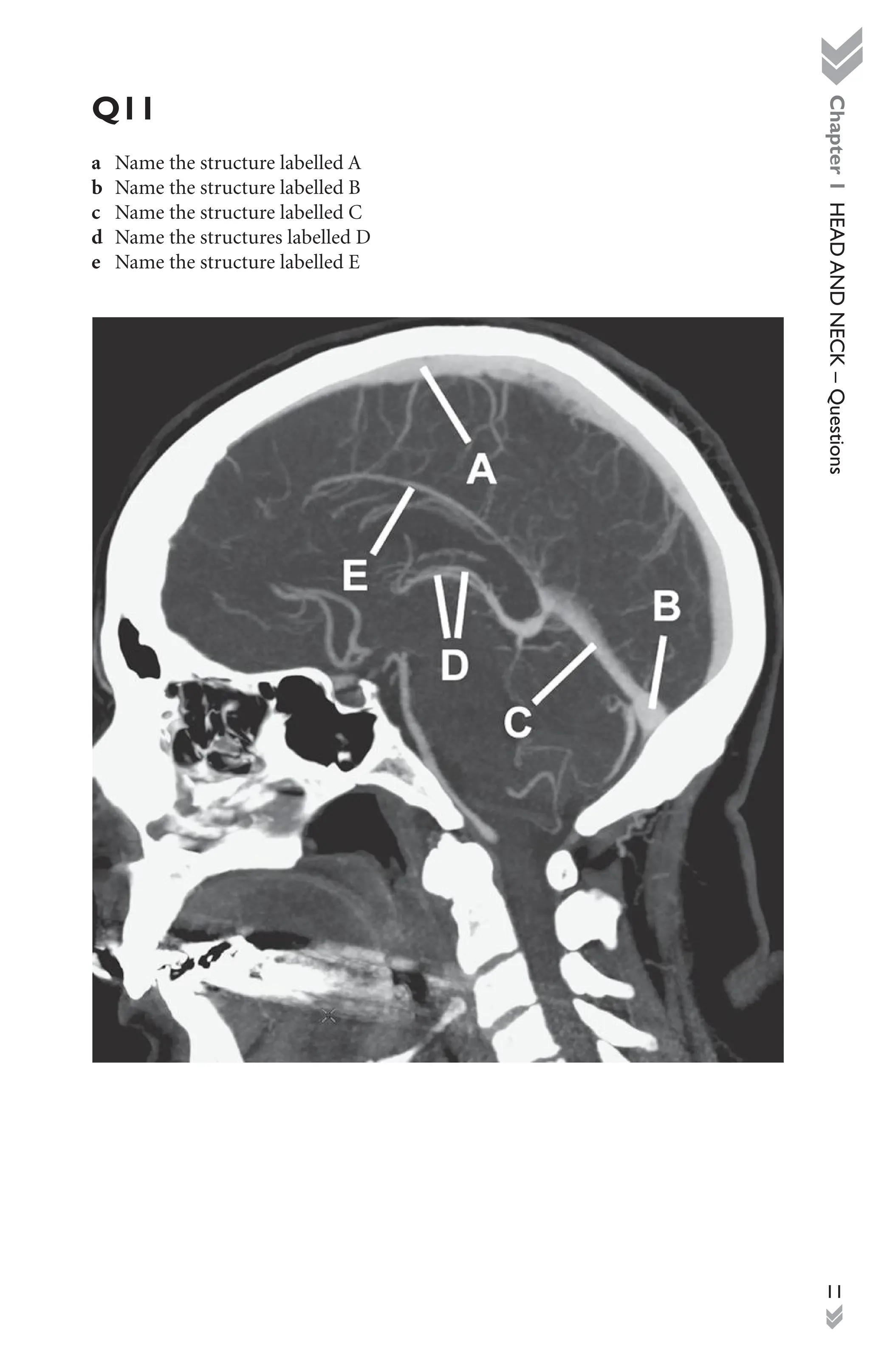 Get Through First FRCR Questions for the Anatomy Module.pdf