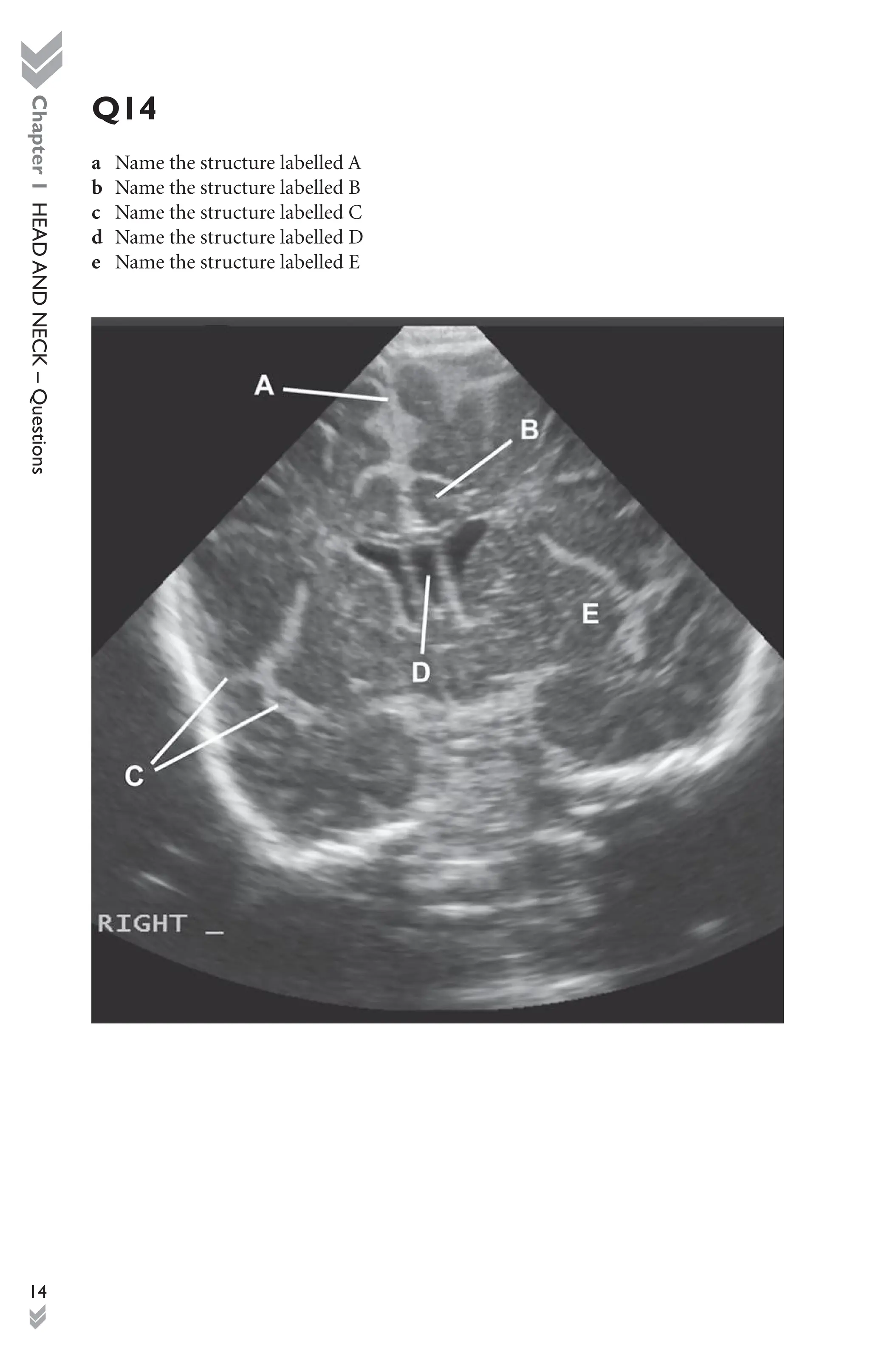 Get Through First FRCR Questions for the Anatomy Module.pdf