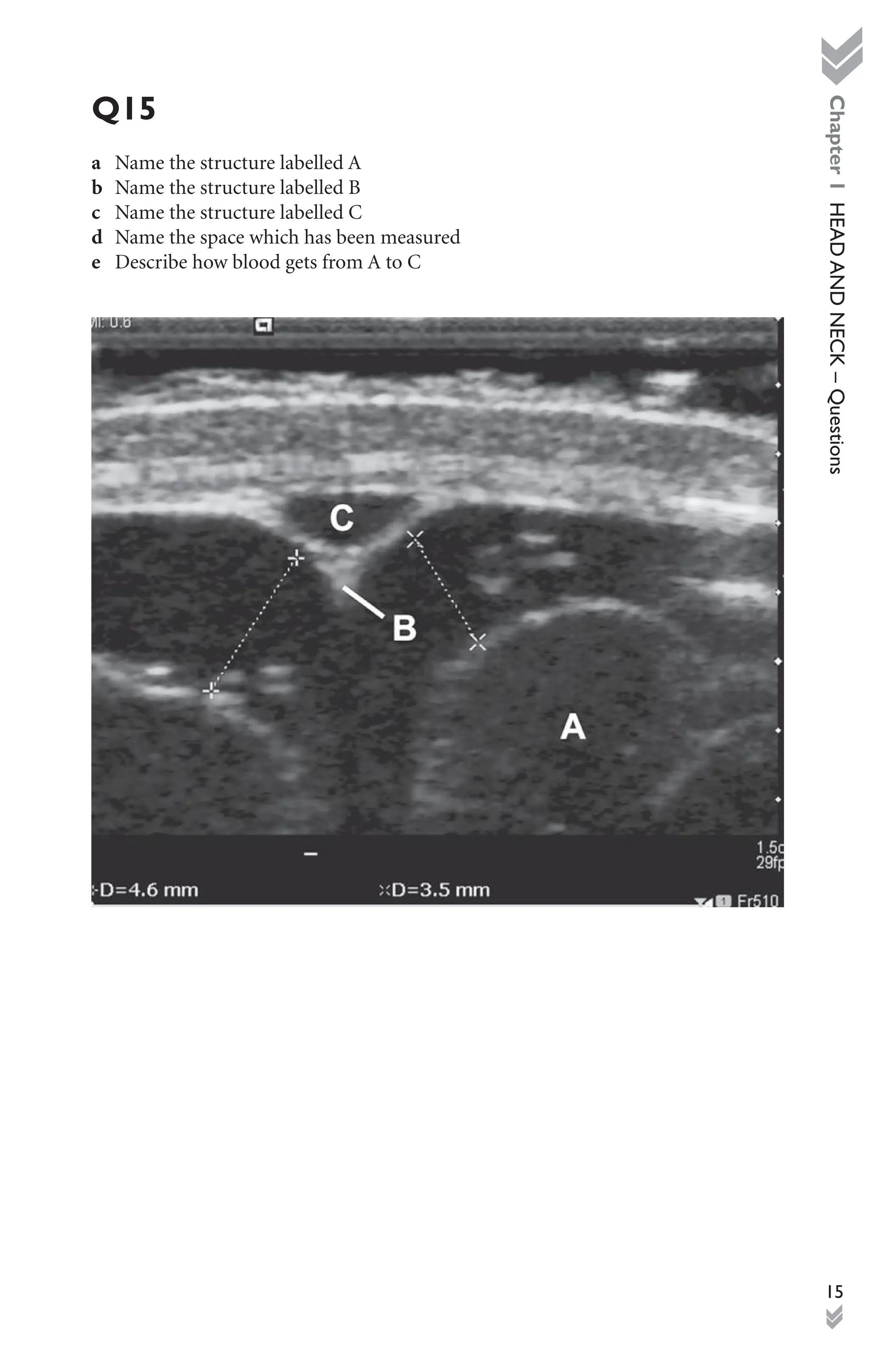 Get Through First FRCR Questions for the Anatomy Module.pdf