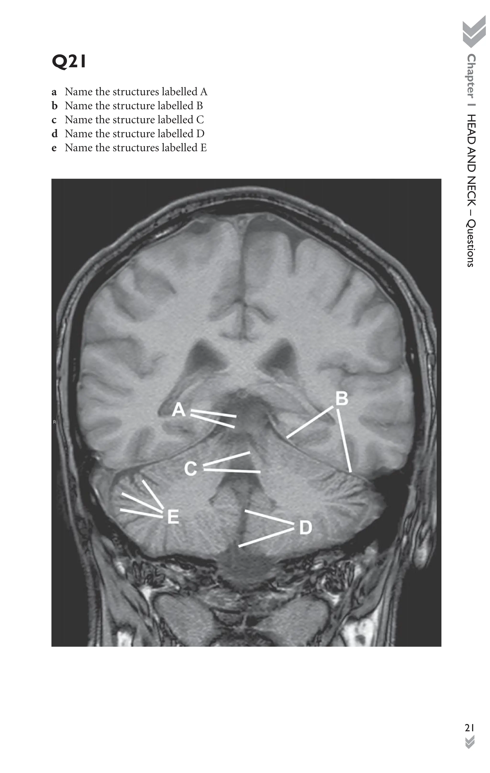 Get Through First FRCR Questions for the Anatomy Module.pdf