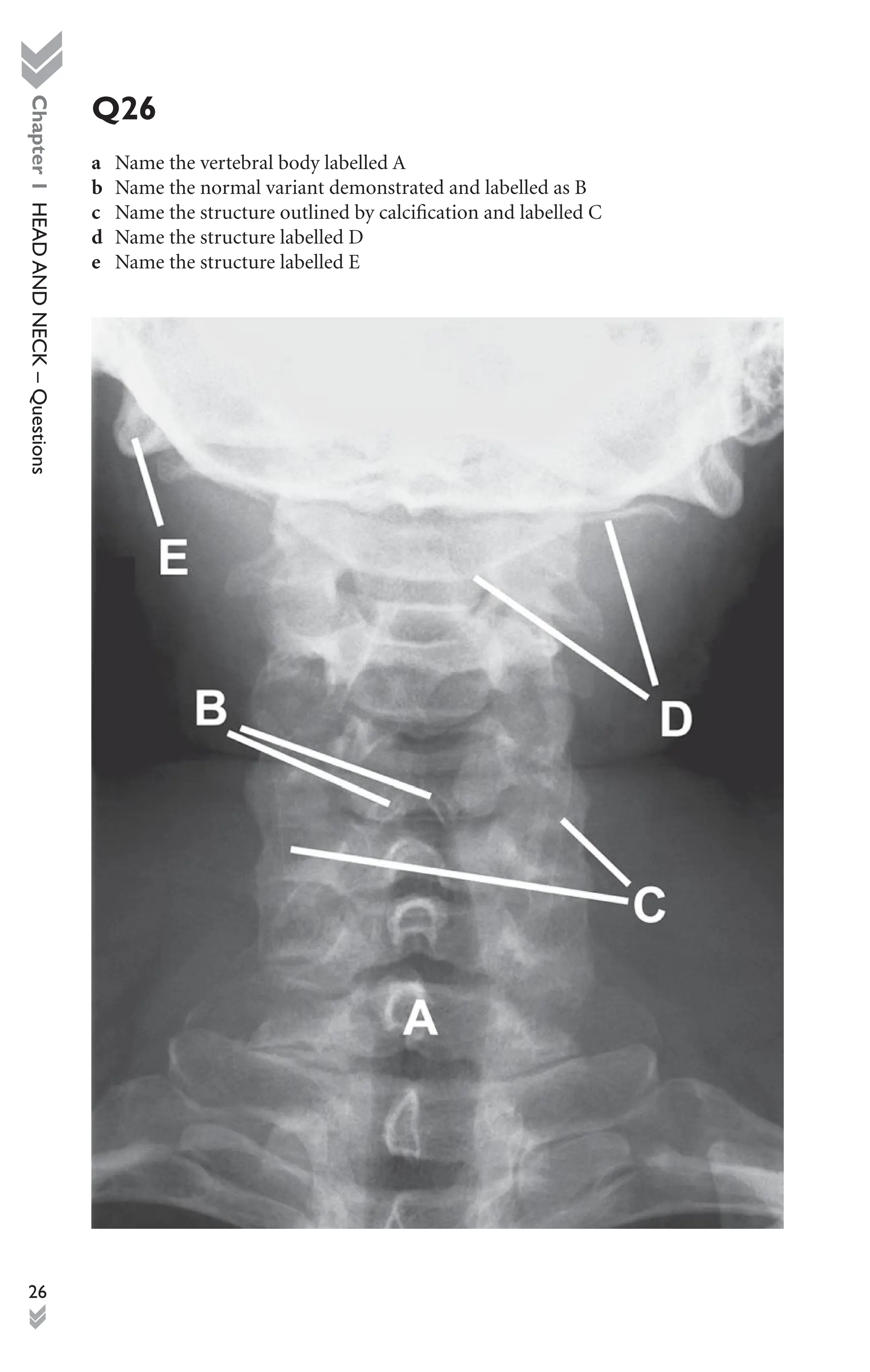 Get Through First FRCR Questions for the Anatomy Module.pdf