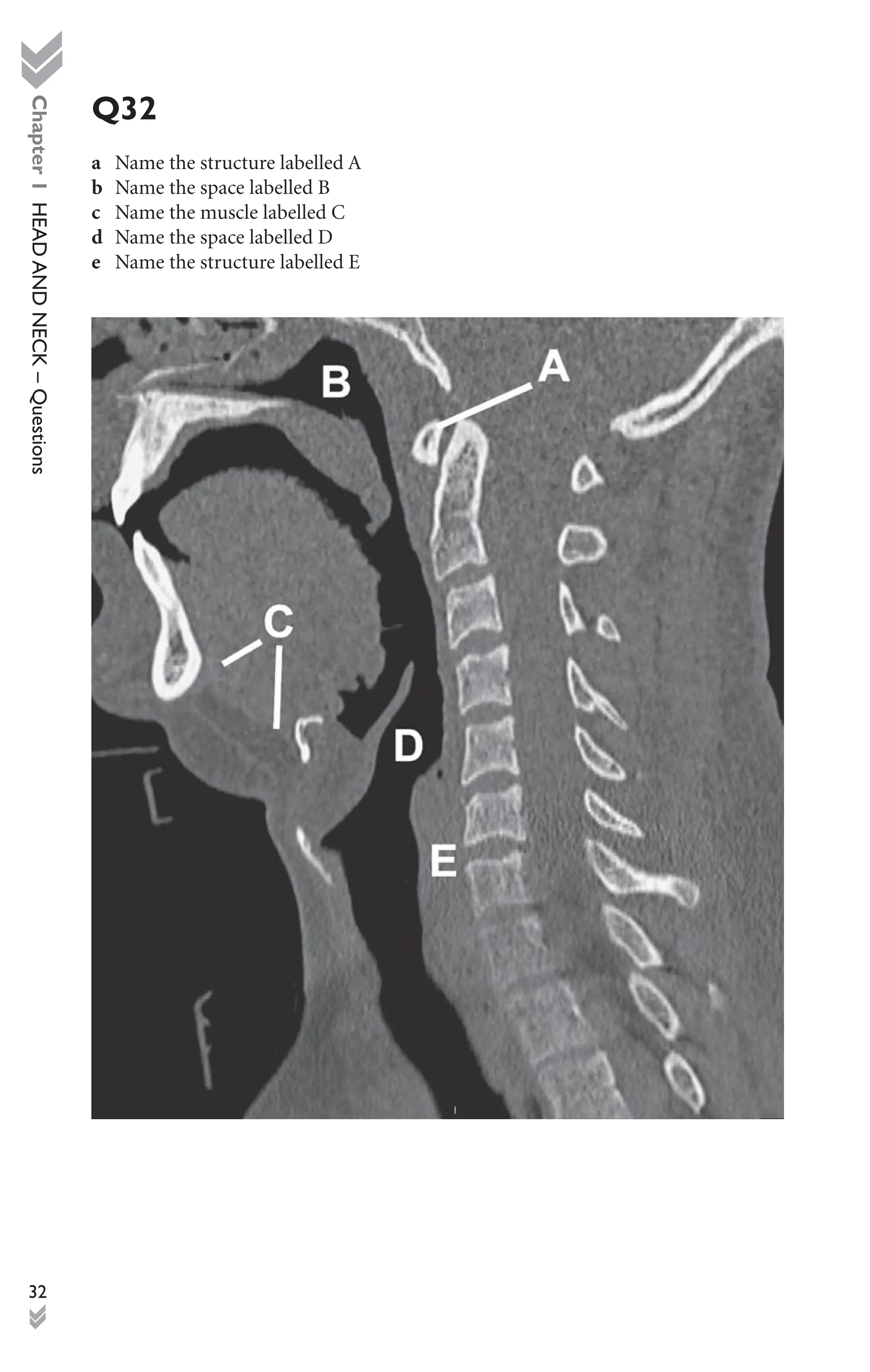 Get Through First FRCR Questions for the Anatomy Module.pdf