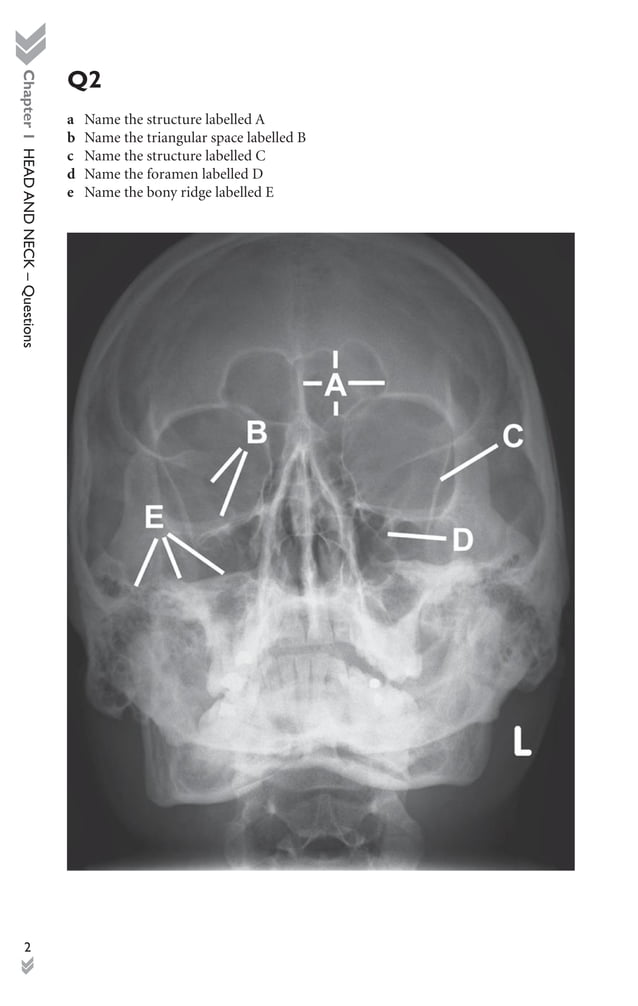 Get Through First FRCR Questions for the Anatomy Module.pdf