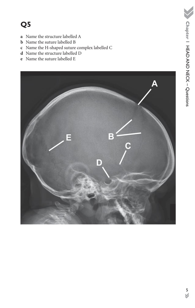 Get Through First FRCR Questions for the Anatomy Module.pdf