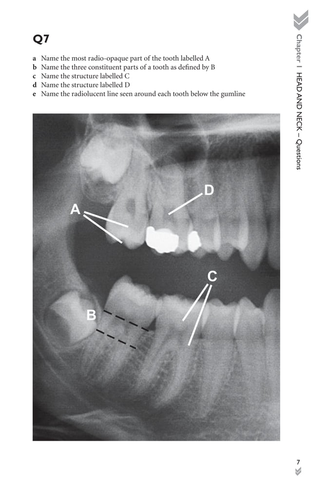 Get Through First FRCR Questions for the Anatomy Module.pdf