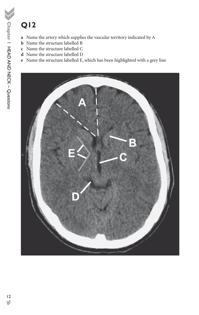 Get Through First FRCR Questions for the Anatomy Module.pdf