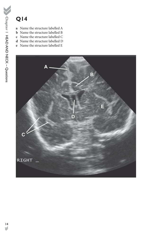 Get Through First FRCR Questions for the Anatomy Module.pdf