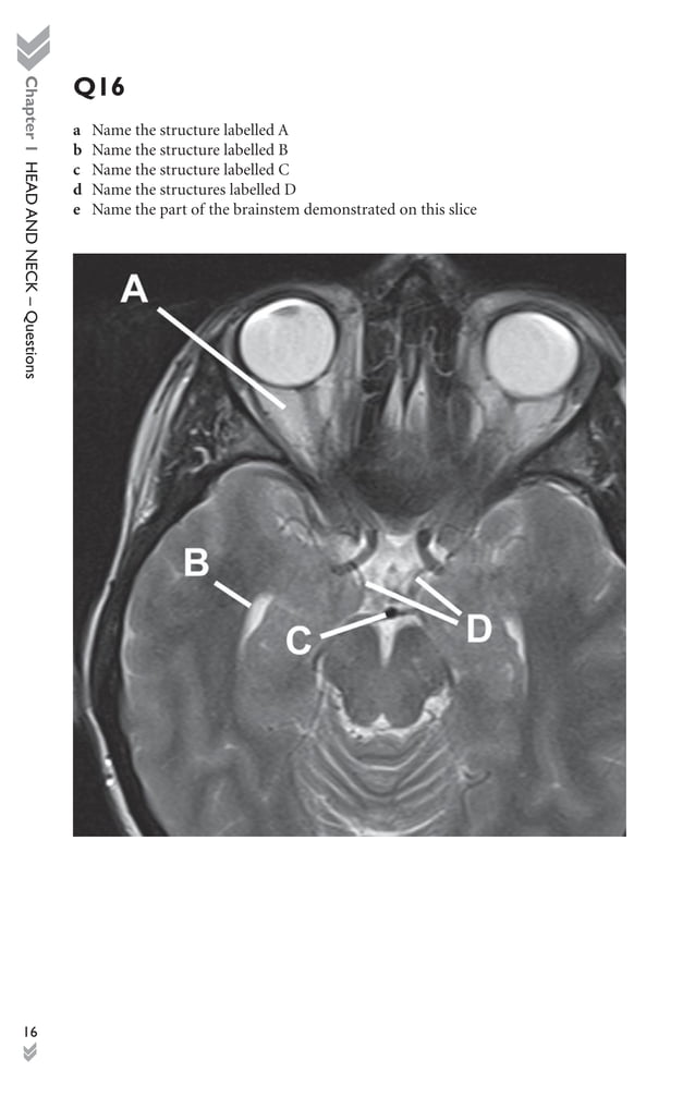 Get Through First FRCR Questions for the Anatomy Module.pdf