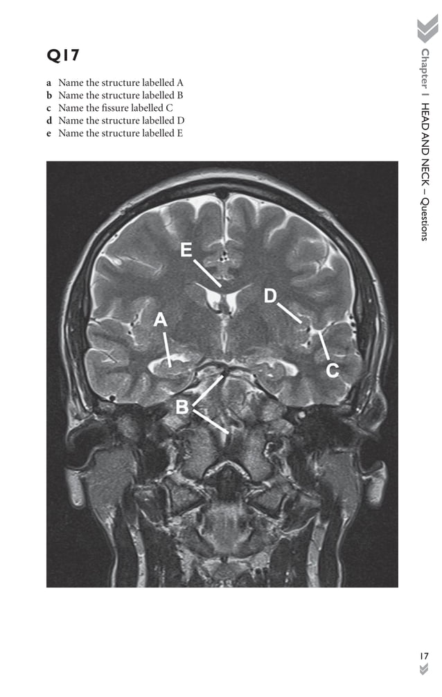 Get Through First FRCR Questions for the Anatomy Module.pdf