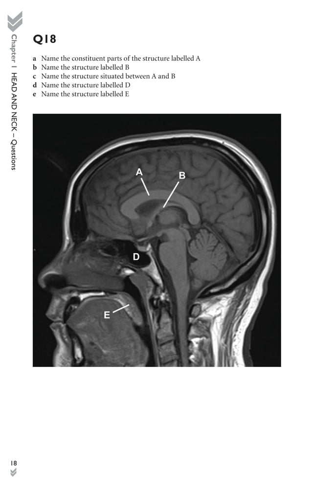 Get Through First FRCR Questions for the Anatomy Module.pdf