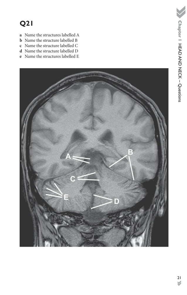 Get Through First FRCR Questions for the Anatomy Module.pdf