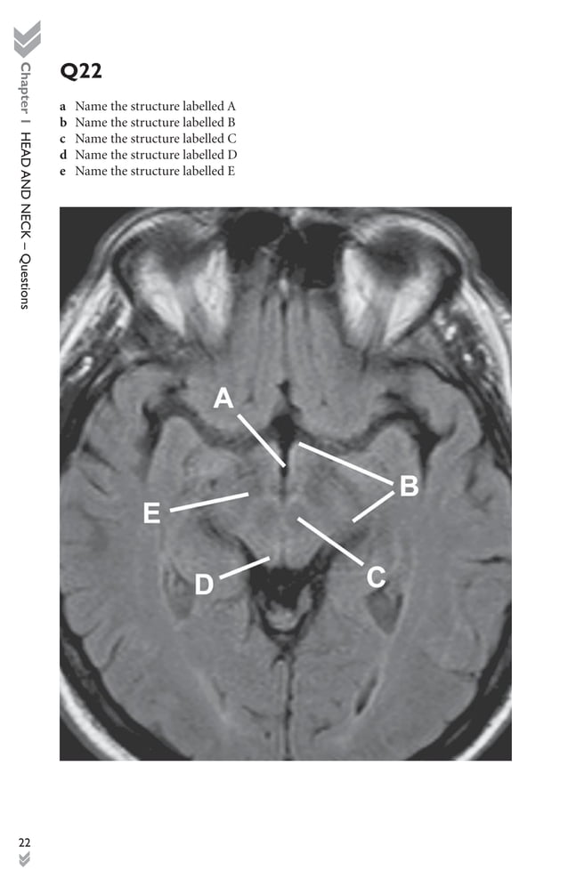 Get Through First FRCR Questions for the Anatomy Module.pdf