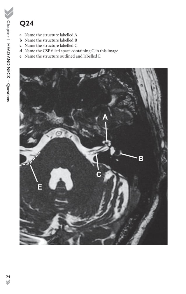 Get Through First FRCR Questions for the Anatomy Module.pdf