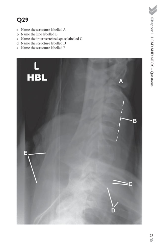 Get Through First FRCR Questions for the Anatomy Module.pdf