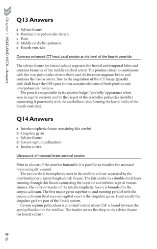 Get Through First FRCR Questions for the Anatomy Module.pdf